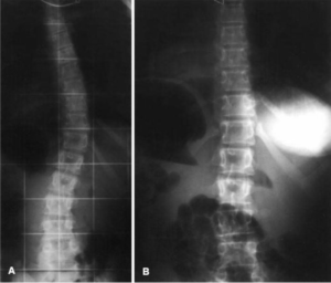 Side shift: The #1 Research-backed Exercise that You Absolutely Should ...