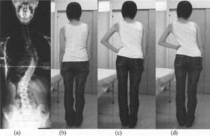 Side shift: The #1 Research-backed Exercise that You Absolutely Should ...